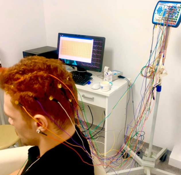 EEG SI VIDEO EEG, de veghe si somn